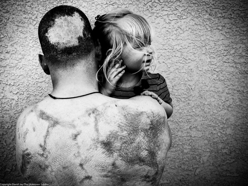 Photo series shows the unseen consequences of war | ksdk.com