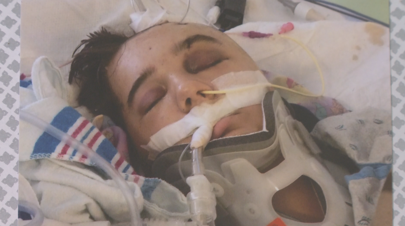 Boy shot in the head thanks doctors, nurses | ksdk.com