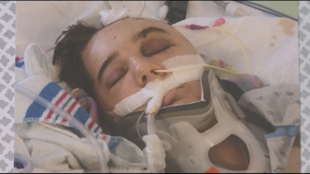 Boy with gunshot wound to the head thanks his doctors and nurses | KSDK.com